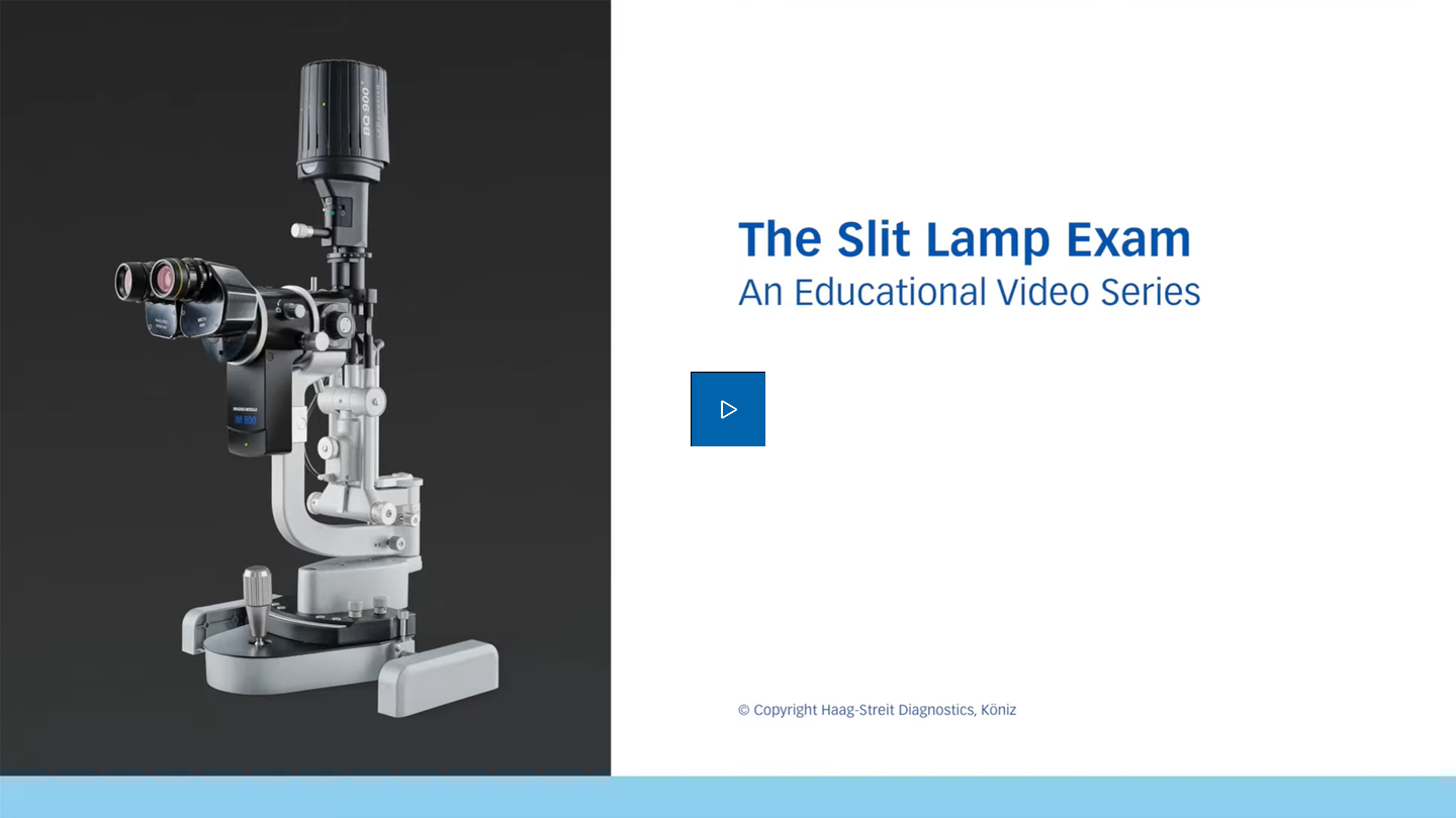 スリットランプ